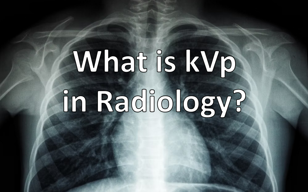 What is kVp in Radiology? Simply Explained - Rad Insights