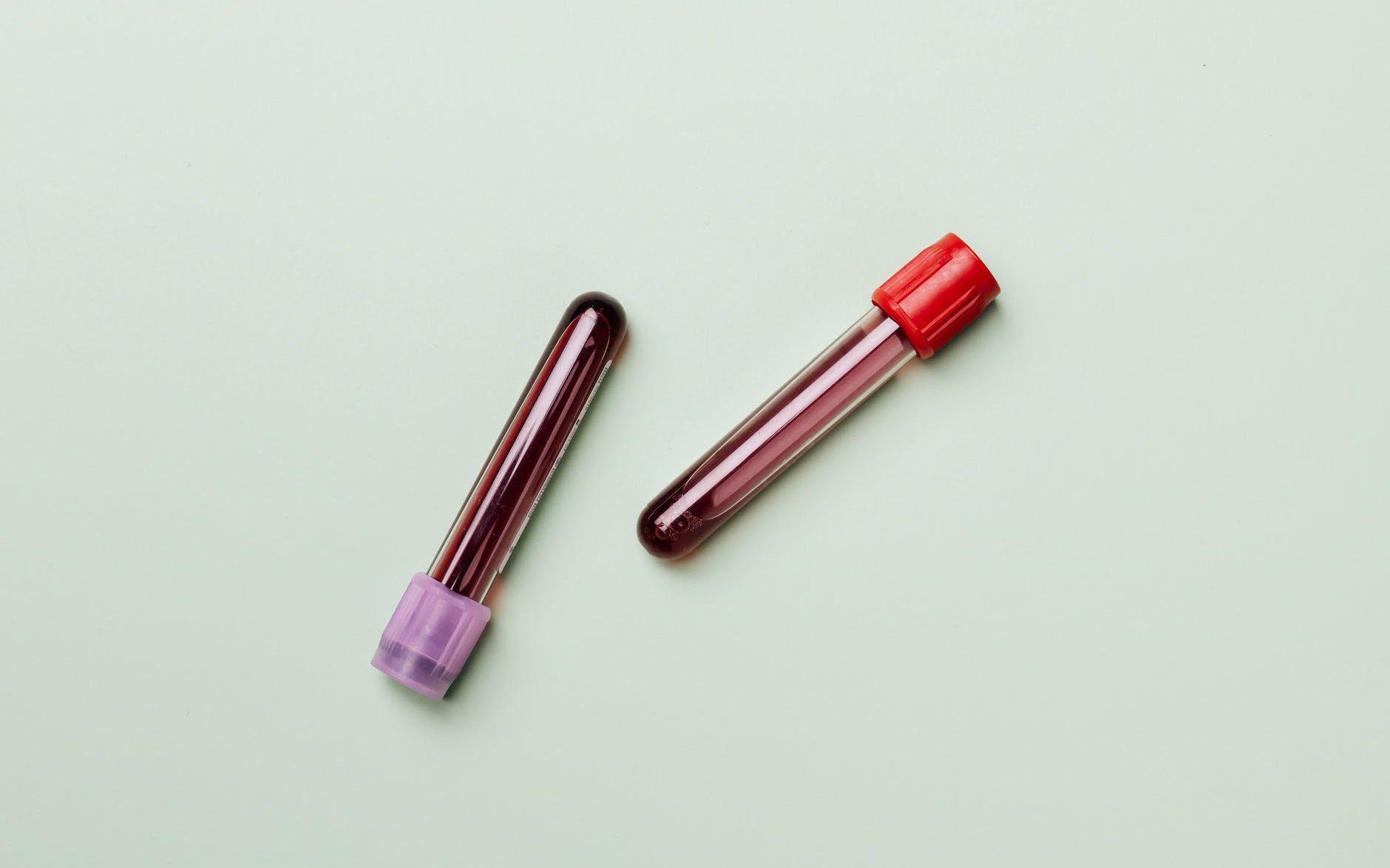 Anemia Detection in Cancer Patients with Photon-Counting CT Technology