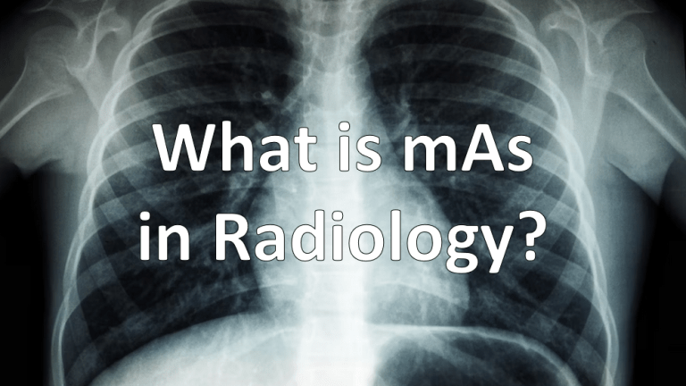 Understanding mAs in Radiology: A Simple Explanation
